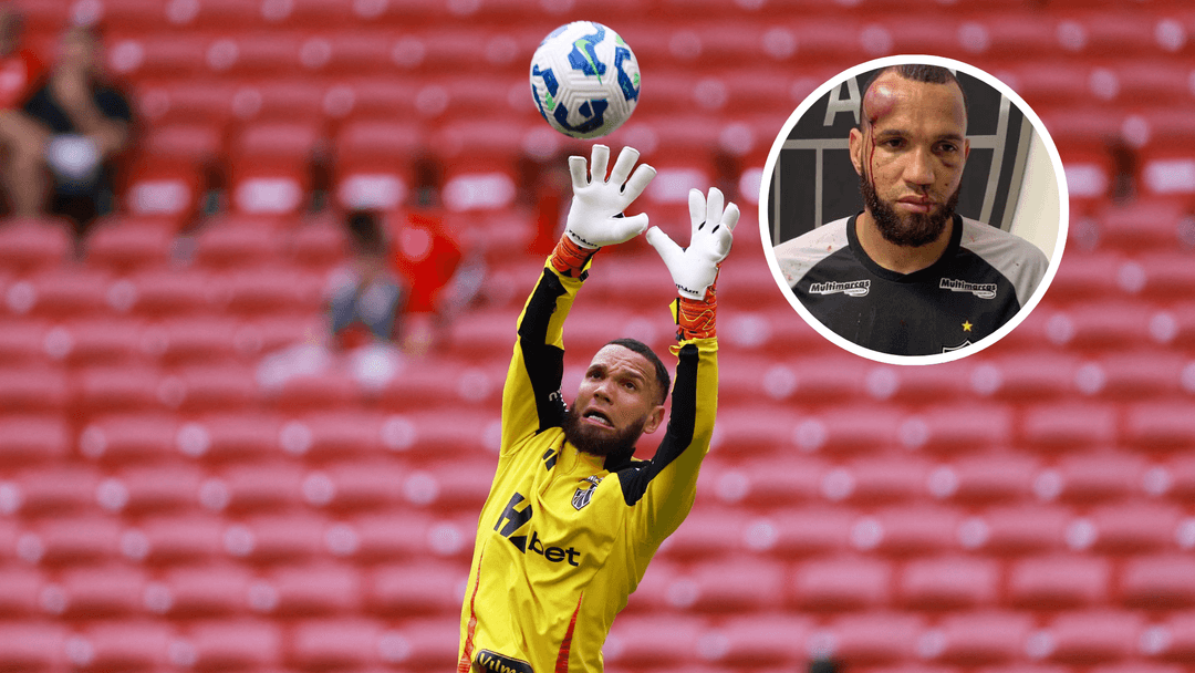 This Is How the Atlético Mineiro Goalkeeper’s Face Looked After the ...