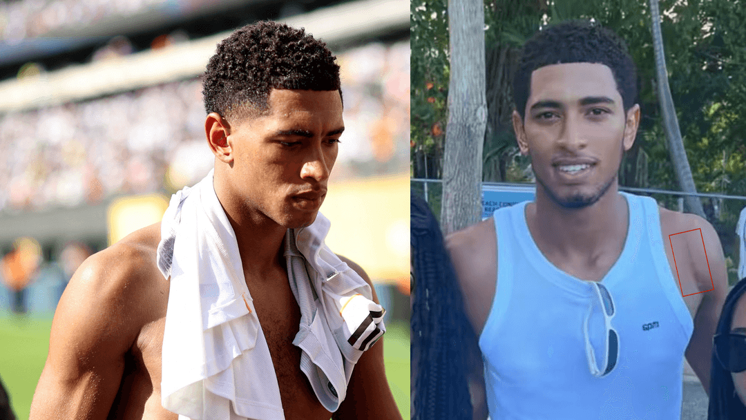 Jude Bellingham Shows the Scar Left by His Shoulder Surgery. | beIN SPORTS